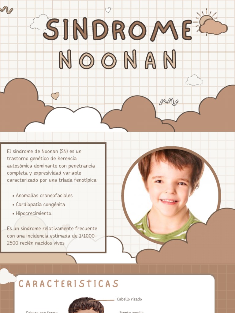 Características clínicas, etiología, diagnóstico y tratamiento del síndrome de Noonan | PDF ...