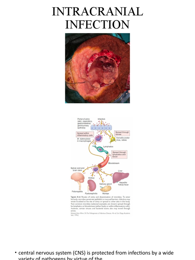 CNS Infection Overview and Management | PDF