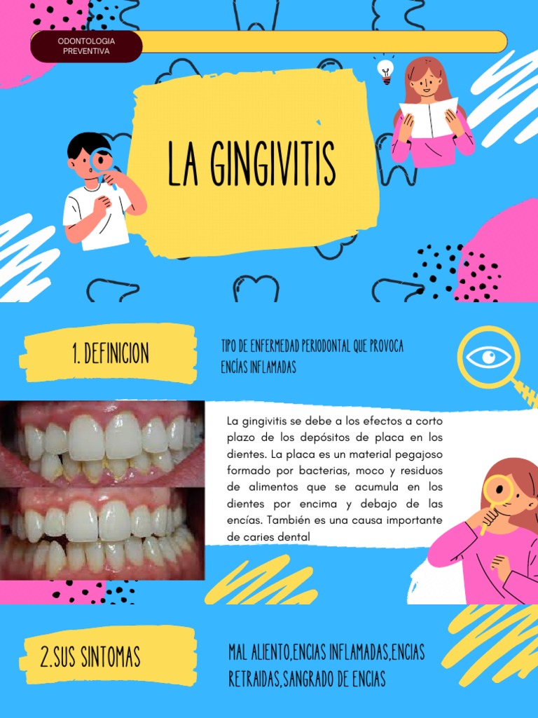 Charla 4 Gingivitis | PDF