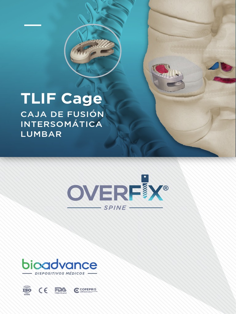 OVERFIX Spine-TLIF Caja Intersomatica Lumbar | PDF | Enfermedades y ...