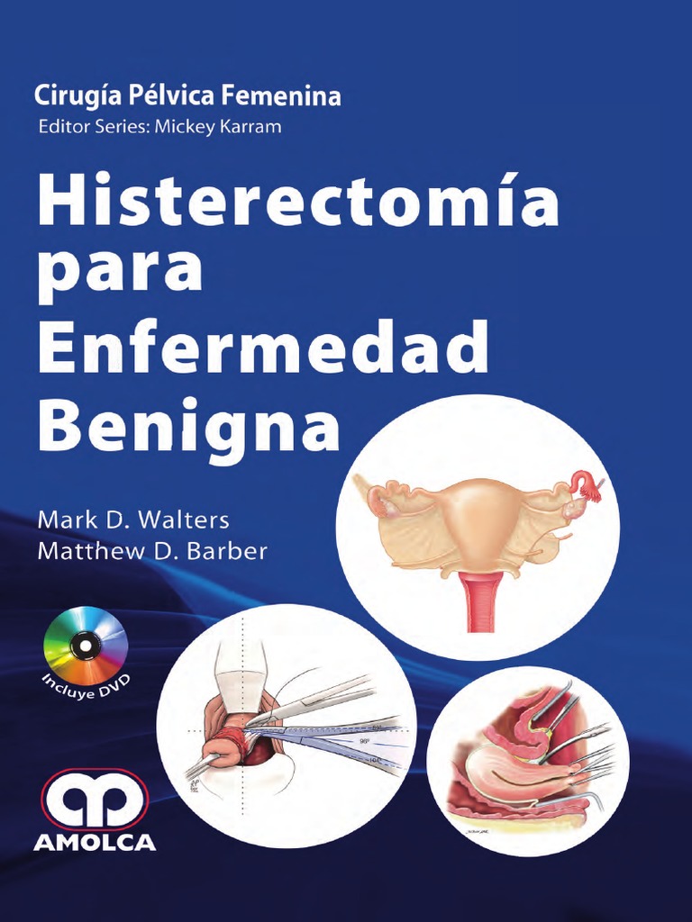 Muestra Histerectomia | PDF | Control de la natalidad | Cirugía