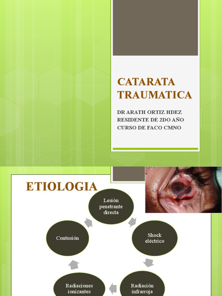 Catarata Traumatica | PDF | Catarata | Cirugía