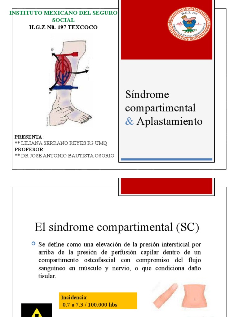 Síndrome Compartimental D | PDF