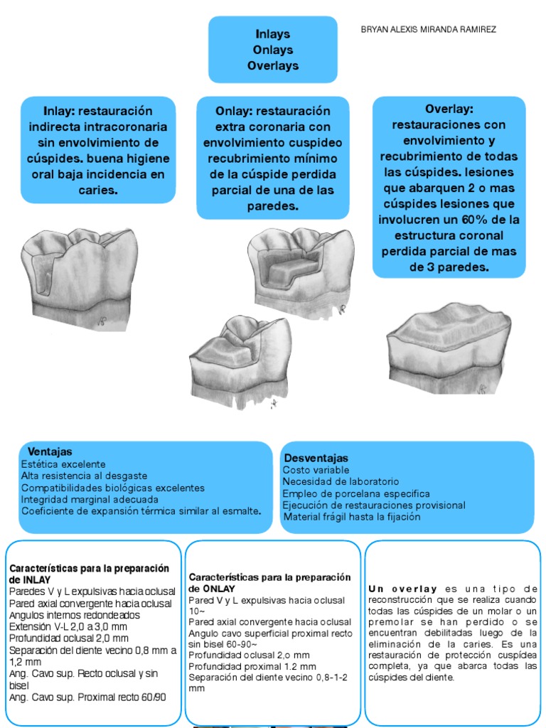 Inlays, Onlas y Overlay | PDF | Ramas de Odontología | Odontología