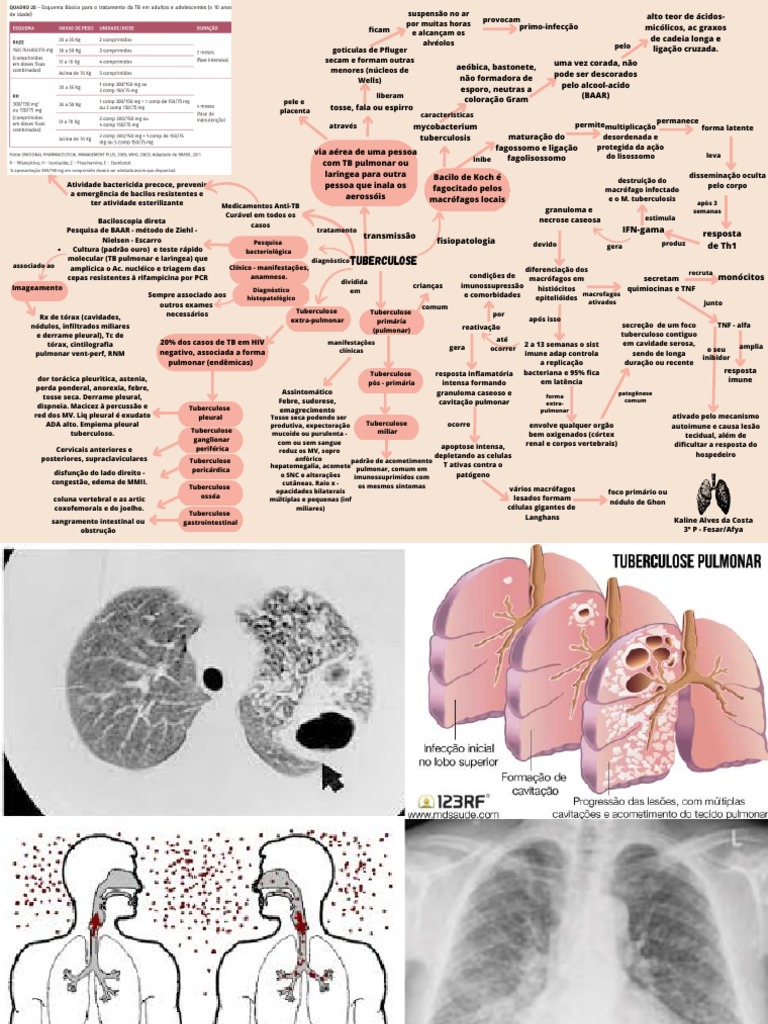 Características, transmissão, diagnóstico e tratamento da tuberculose ...