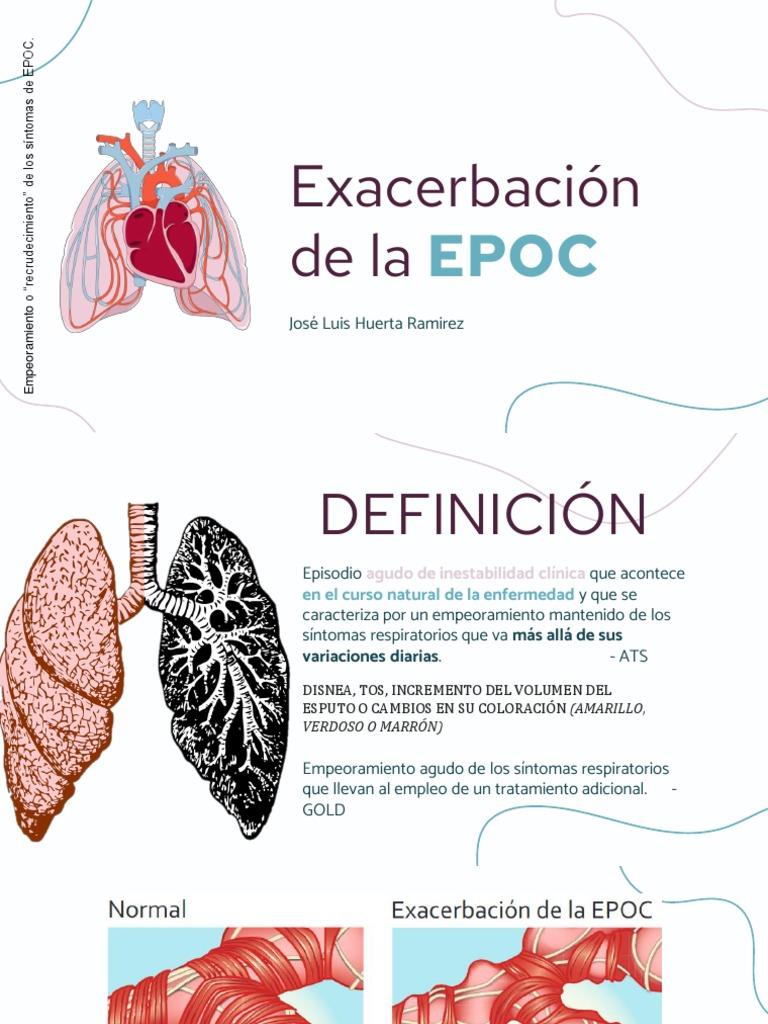 Exacerbación de La EPOC | PDF