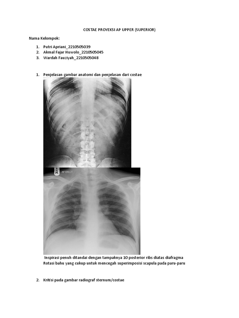 Costae Proyeksi Ap Upper | PDF