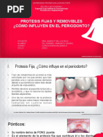 Tipos y funciones del póntico en prótesis fija | PDF | Dentadura ...