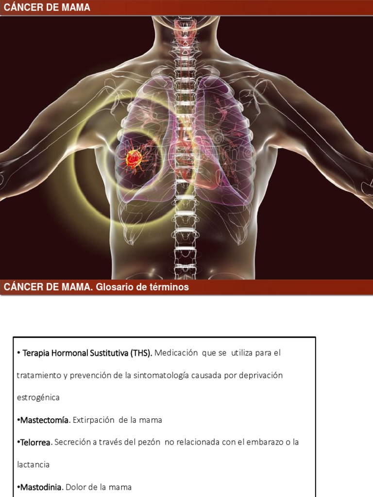 Cancer de Mama | PDF | Cáncer de mama | Biopsia