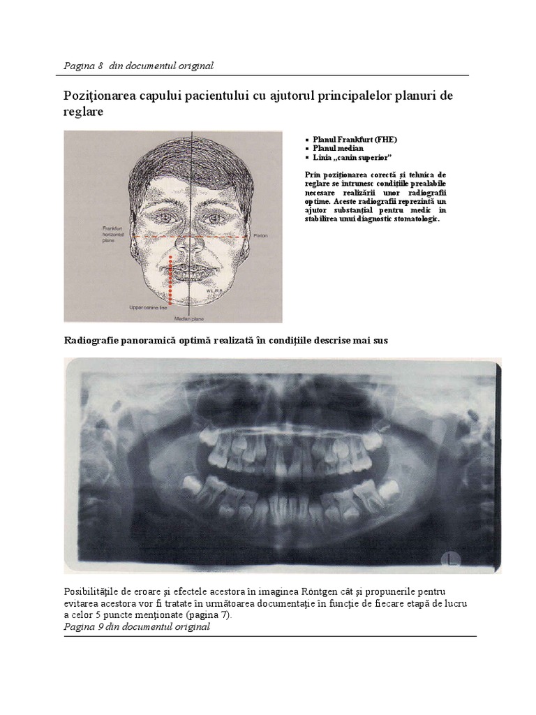 Erori de Pozitionare La OPG | PDF
