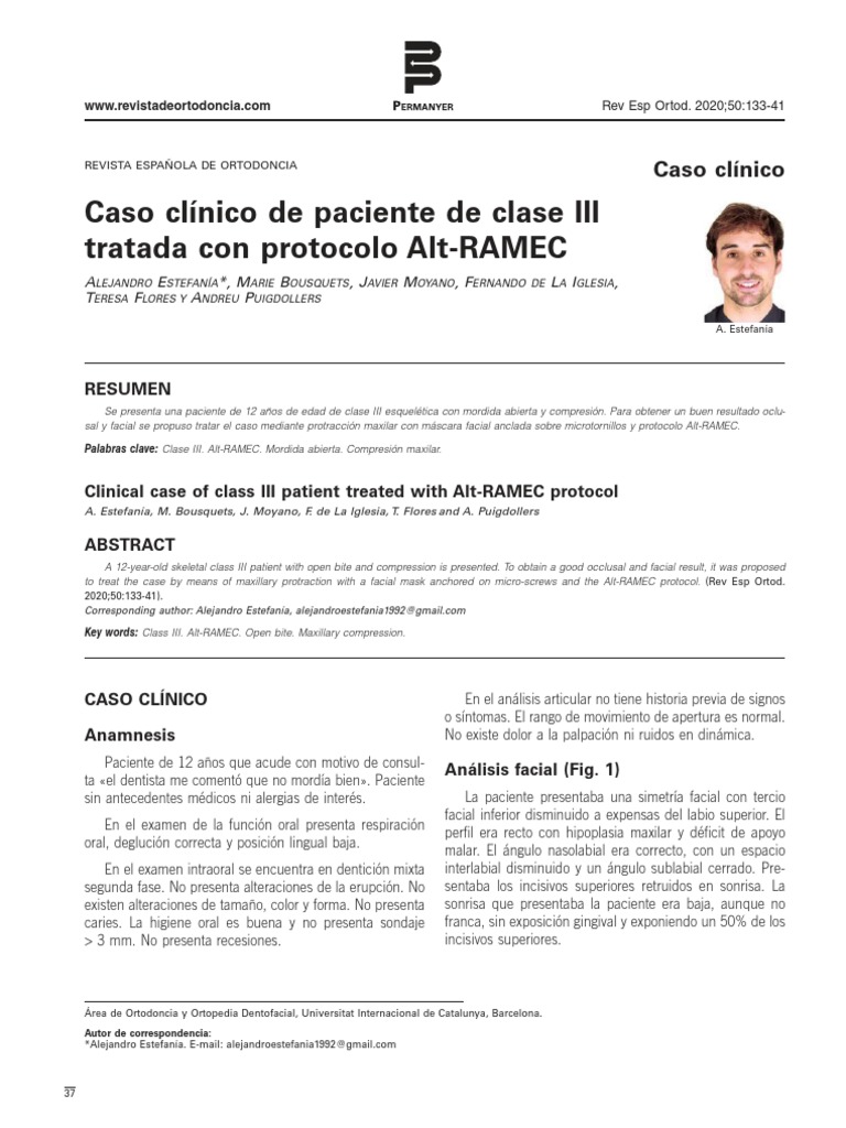 Caso Clínico de Paciente de Clase III Tratada Con Protocolo Alt-RAMEC ...