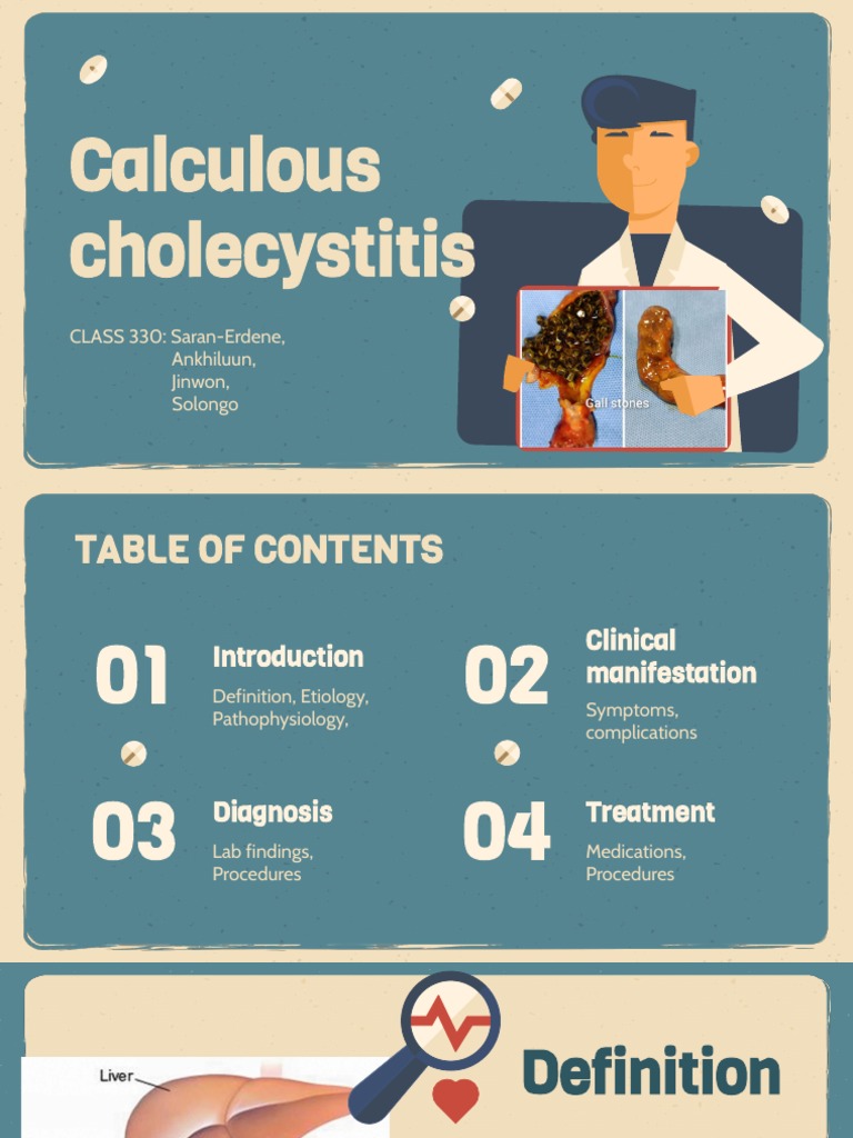 Calculous-cholecystitis | PDF