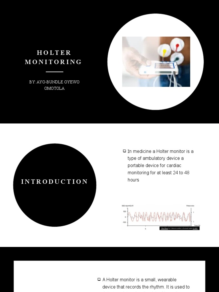 Holter Monitoring | PDF | Electrocardiography | Physiology