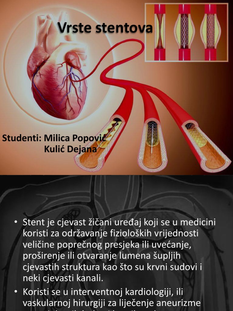 Vrste Stentova Milica Popović Kulić Dejana | PDF
