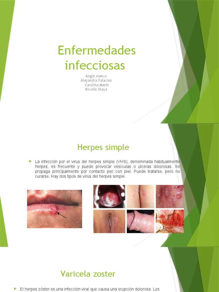 Enfermedades Infecciosas | PDF Enfermedades Infecciosas | PDF