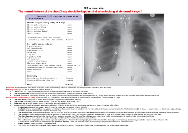 CXR Interpretation Checklist Short | PDF | Lung | Thorax