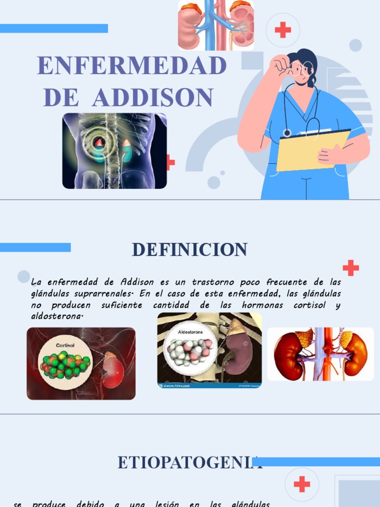Enfermedad de Addison | PDF