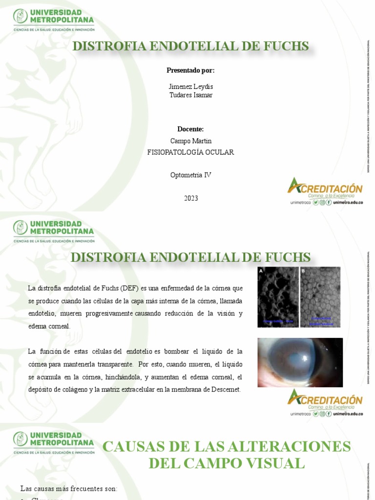 Distrofia de Fuchs | PDF | Percepción visual | Córnea