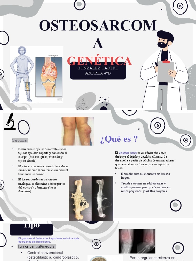 Osteosarcoma: Cáncer óseo en niños | PDF | Cáncer | Gen supresor de tumores