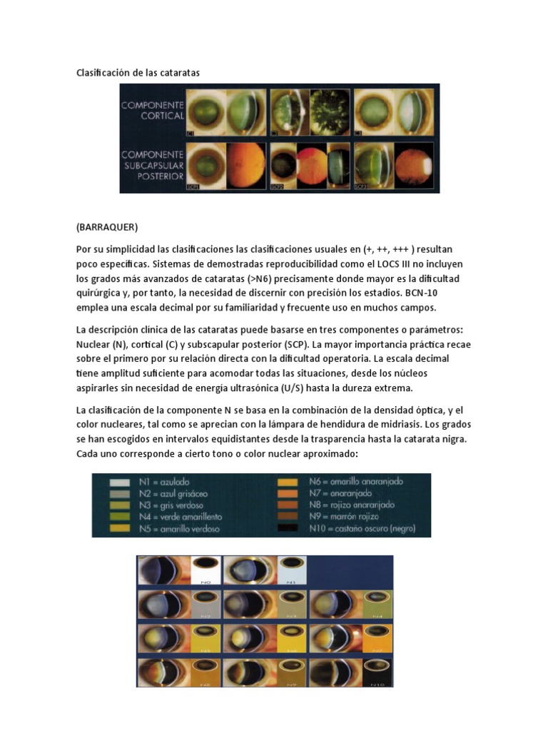 Clasificación de Cataratas LOCS III | PDF | Catarata | Nucleo celular