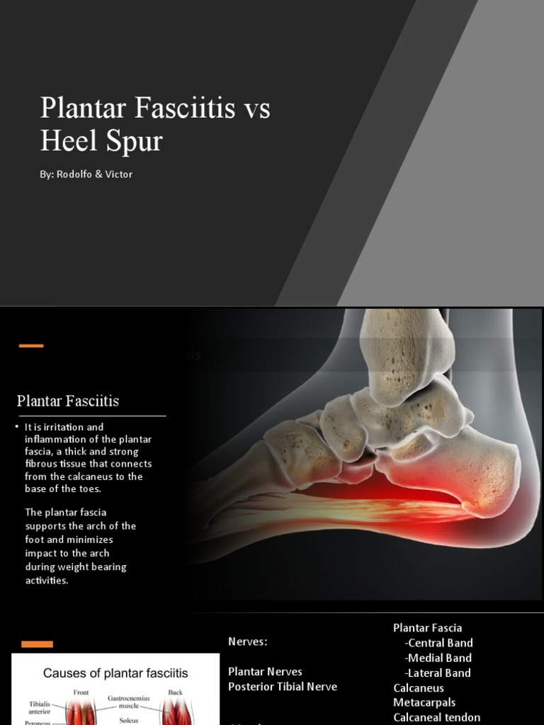 plantar fasciitis vs heel spur | PDF plantar fasciitis vs heel spur | PDF