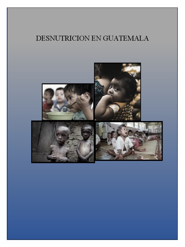 Presentacion Desnutricion En Guatemala Pdf