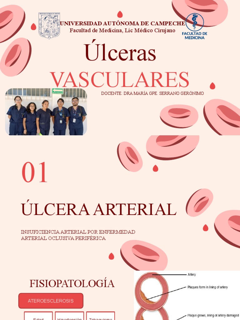 Ulceras Vasculares | PDF