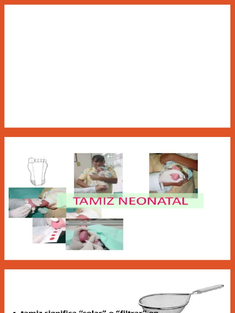 Tamiz Neonatal | PDF