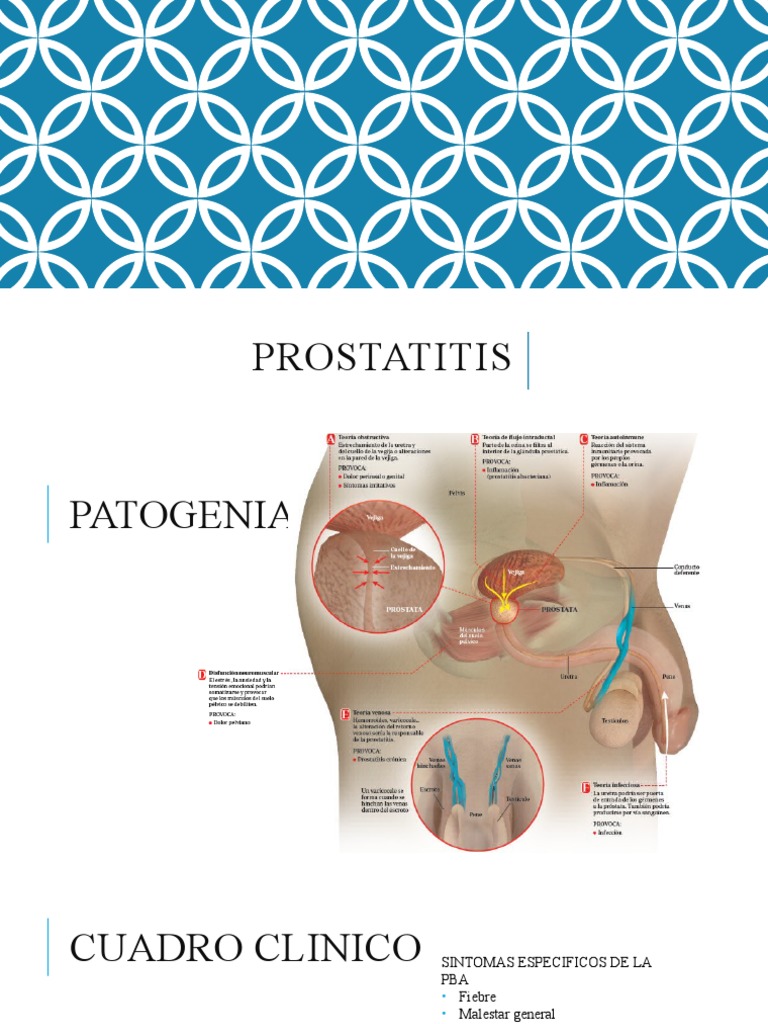 PROSTATITi S | PDF