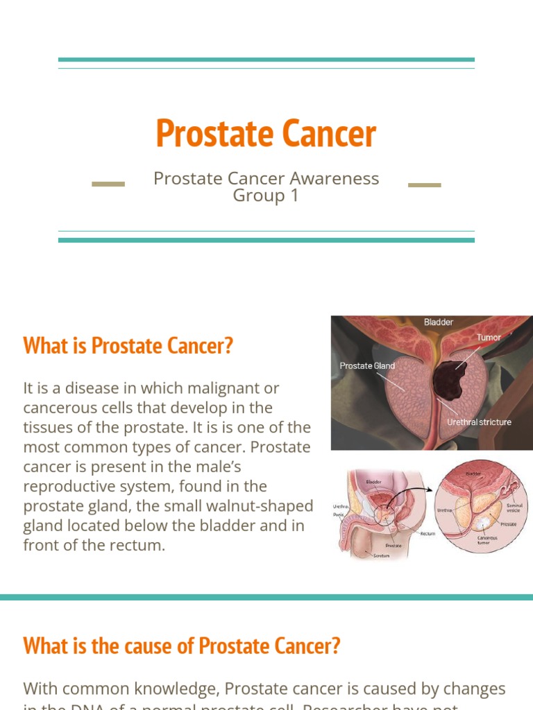 Prostate Cancer | PDF