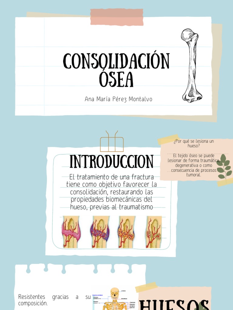 Consolidación Ósea | PDF | Hueso | Anatomía