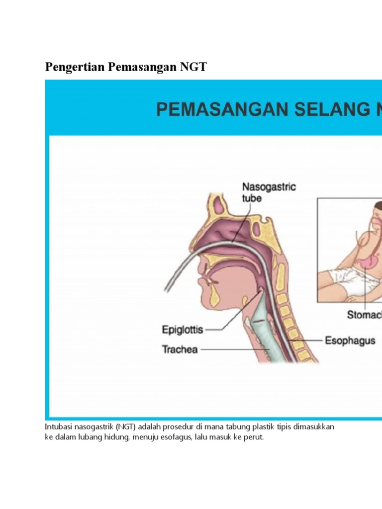 Pengertian Pemasangan NGT | PDF