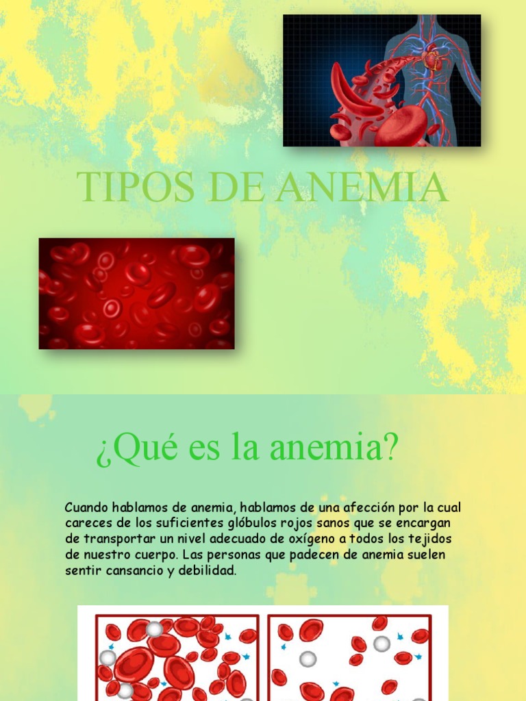 Tipos de Anemia y Sus Causas | PDF