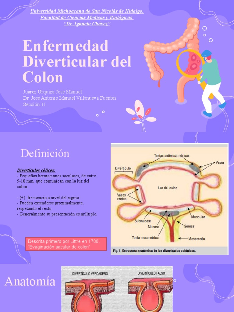Guía sobre la Enfermedad Diverticular del Colon | PDF