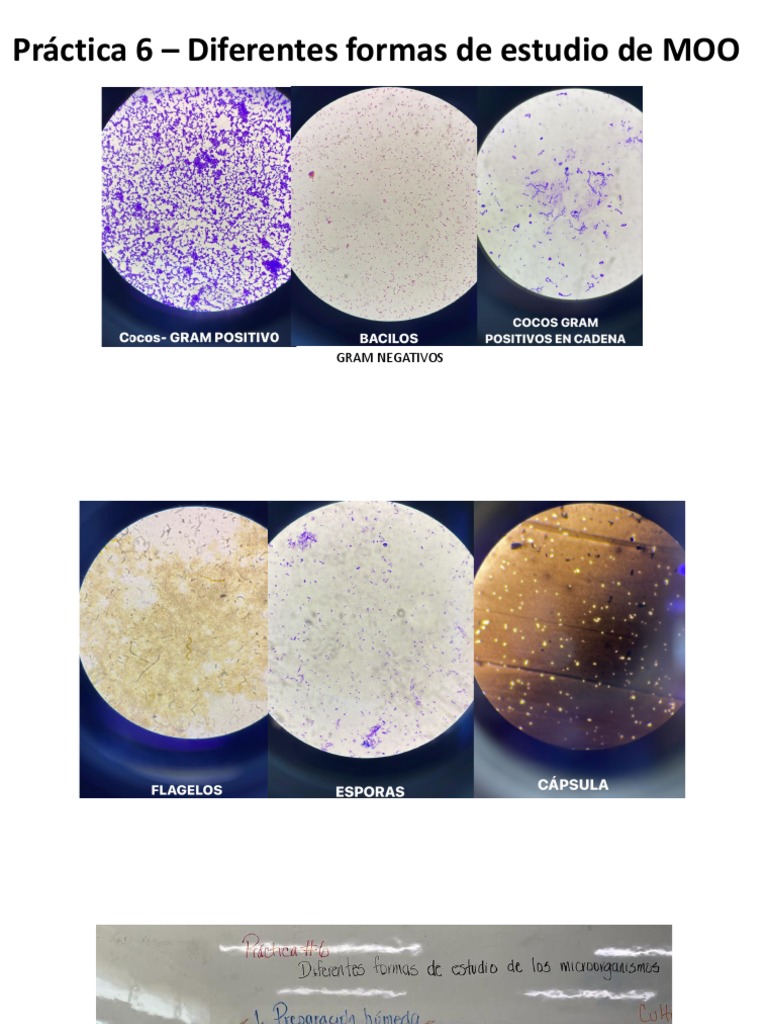 Micro Lab 2 - Placas y Teoria | PDF | Bacterias Gram-negativo | Las bacterias