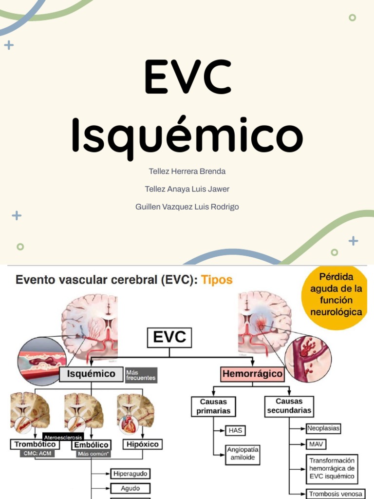 EVC Isquemico | PDF