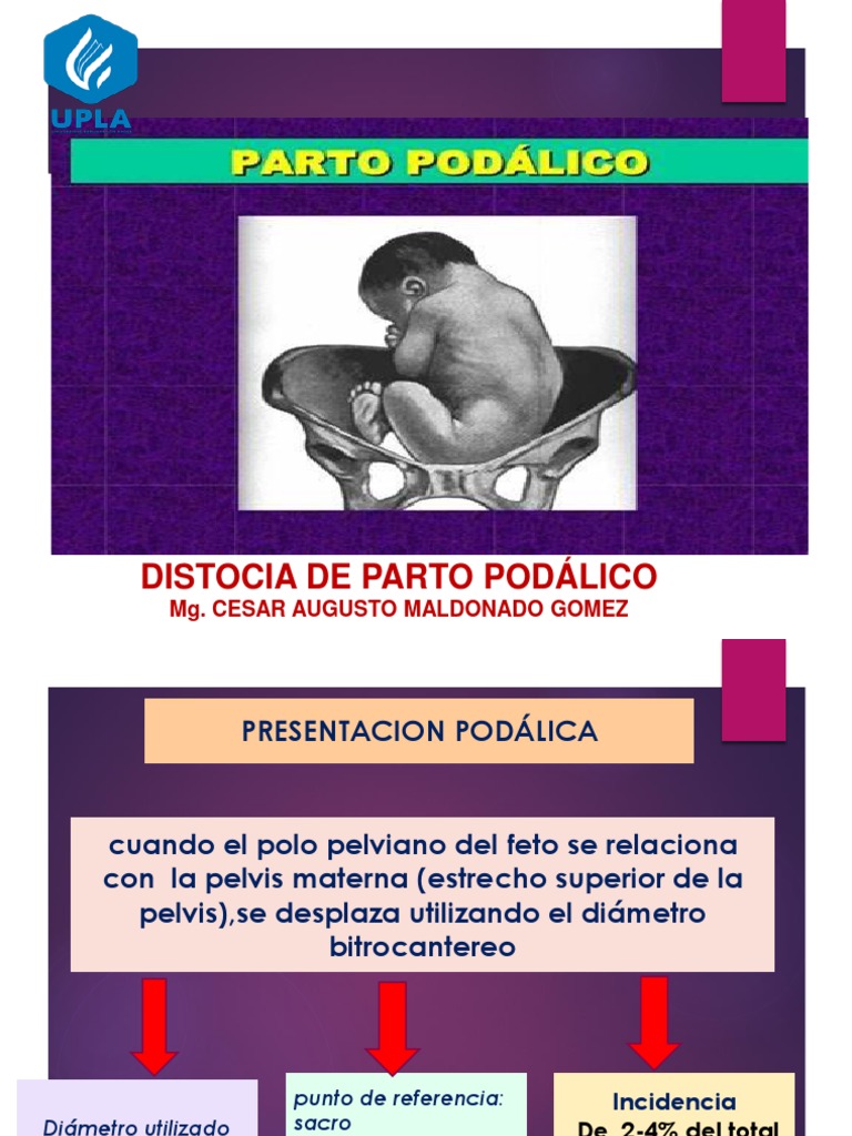 Distocia en Parto Podálico: Mecanismos y Manejo | PDF | Parto | Feto