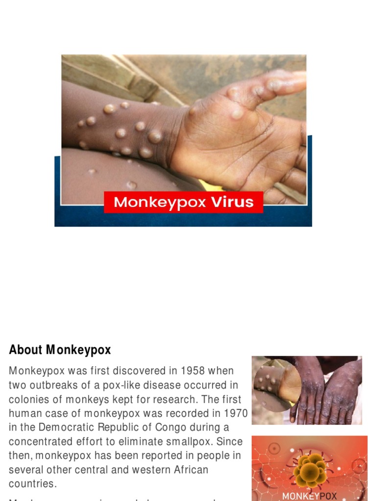 Monkeypox Virus PDF | PDF