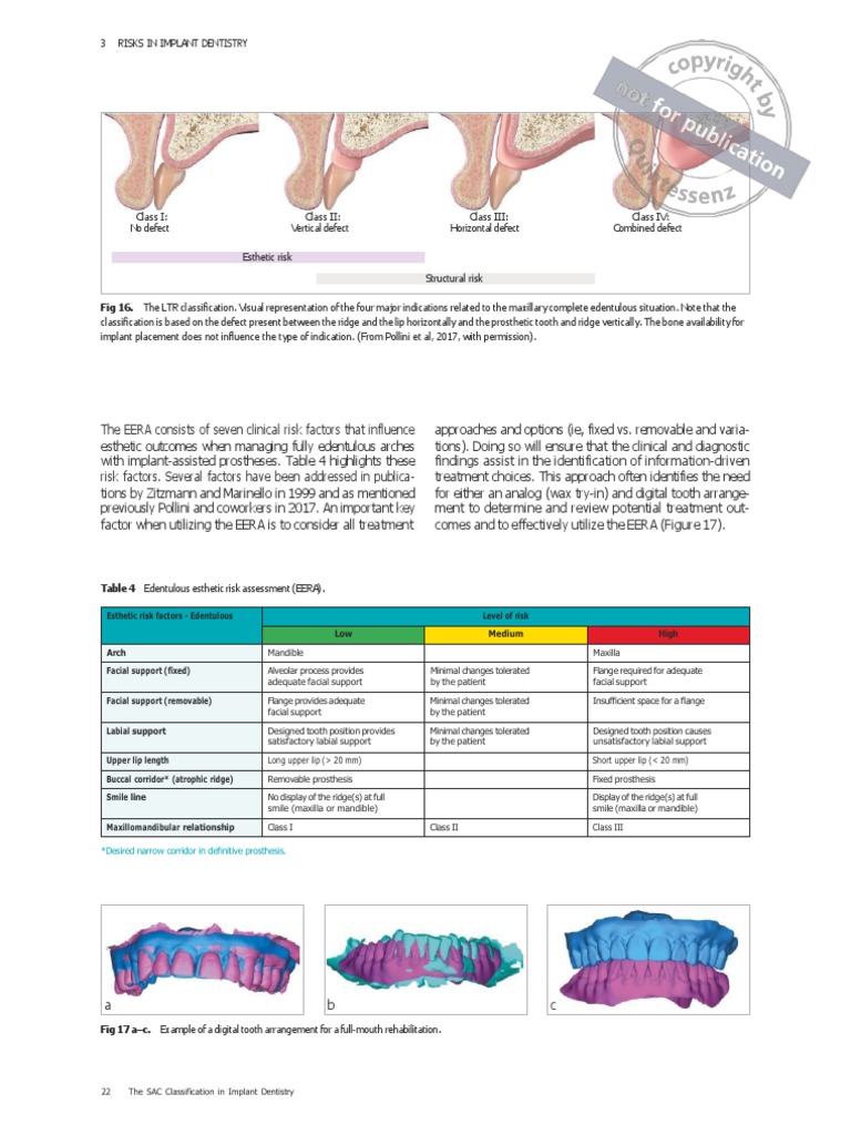 Edentulous Esthetic Risk Assessment Implant | PDF | Dental Implant | Prosthesis