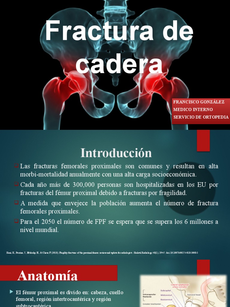 Fractura de Cadera Francisco Antonio Gonzalez | PDF | Medicina CLINICA ...