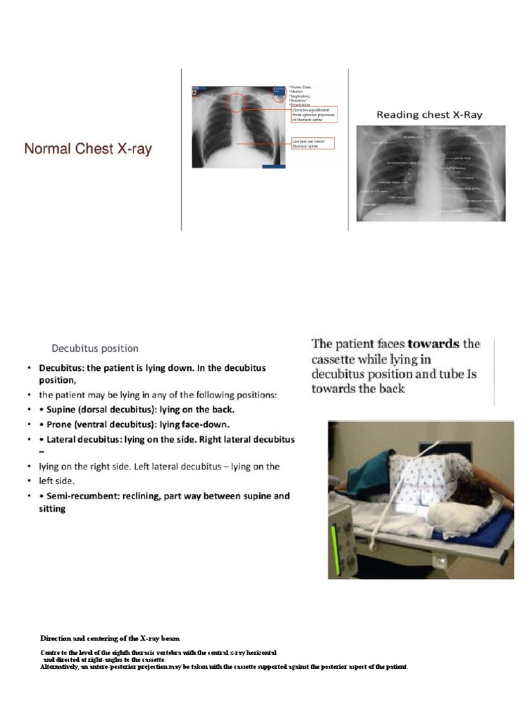 Lung Position 2 | PDF