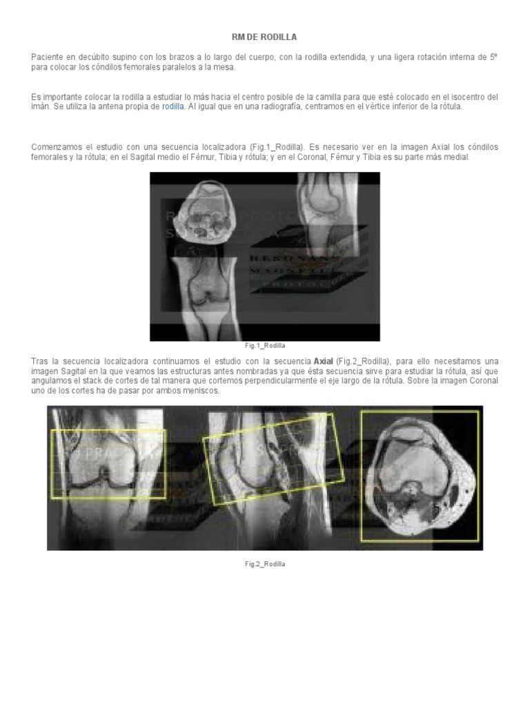 RM de Rodilla | PDF | Rodilla | Sistema musculoesquelético