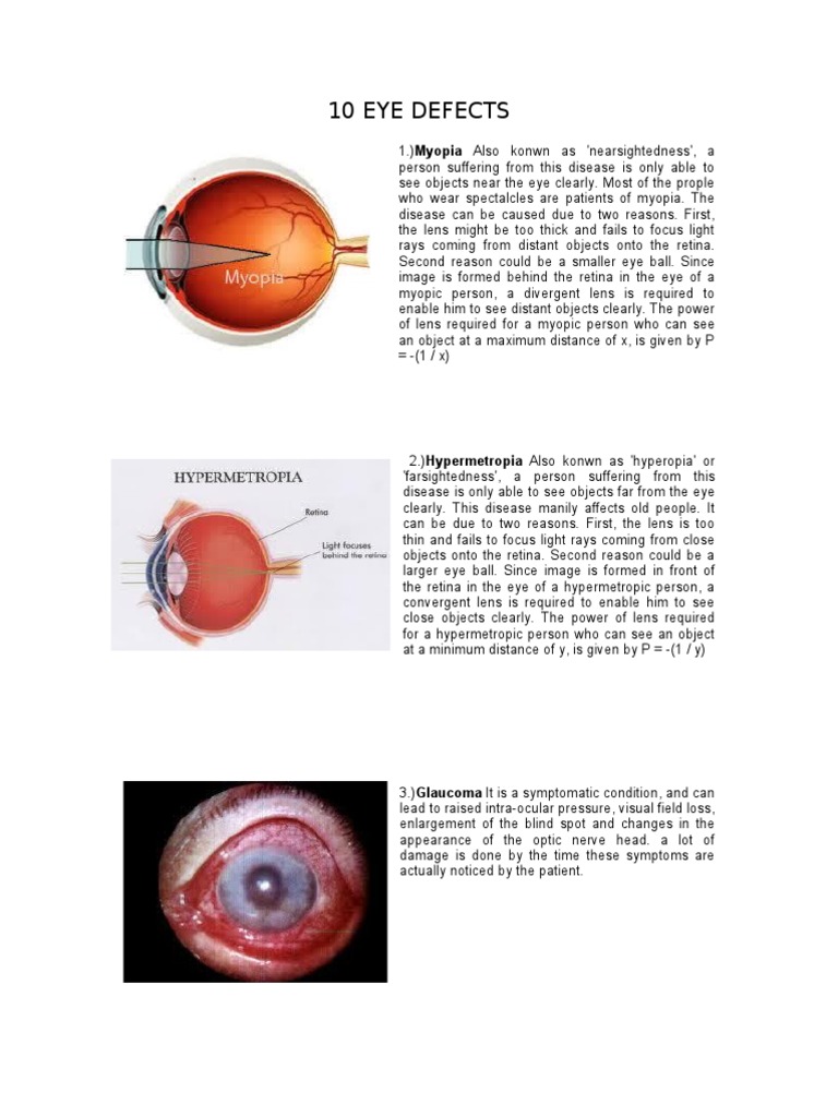 10 Eye Defects | PDF | Telescope | Lens (Optics)