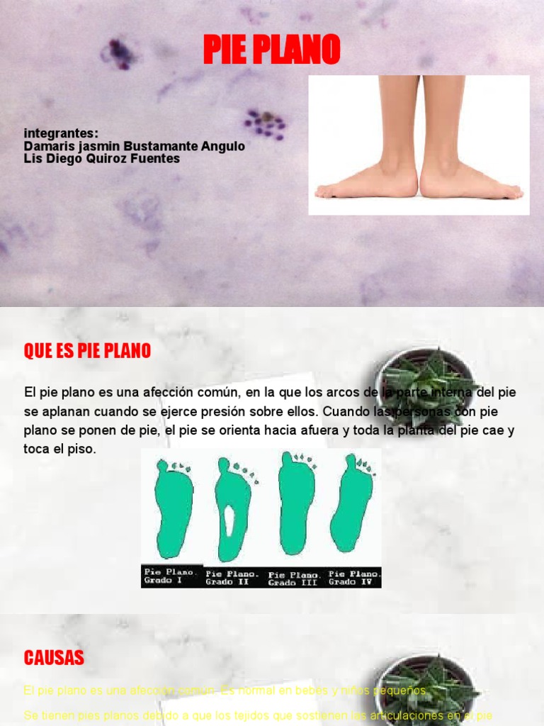 Pie Plano | PDF | Pie | Terapia física