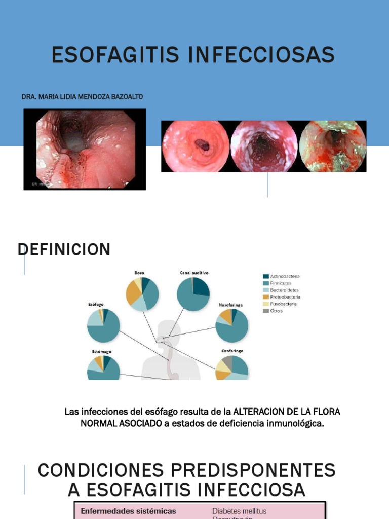 Esofagitis Infecciosa | PDF