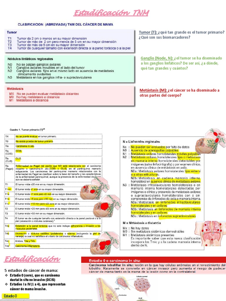 Ca Mama - Clasificación TNM y Tto | PDF | Cáncer de mama | Cáncer