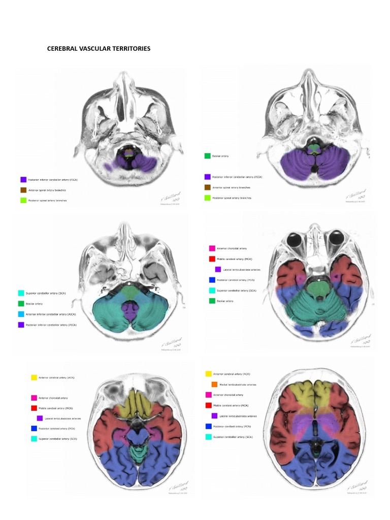 Cerebral Cortical Vascular Territories | PDF