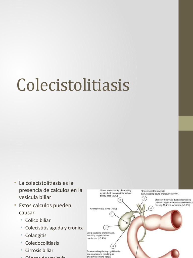 Copia de Colecistolitiasis | PDF | Bilis | Vesícula biliar
