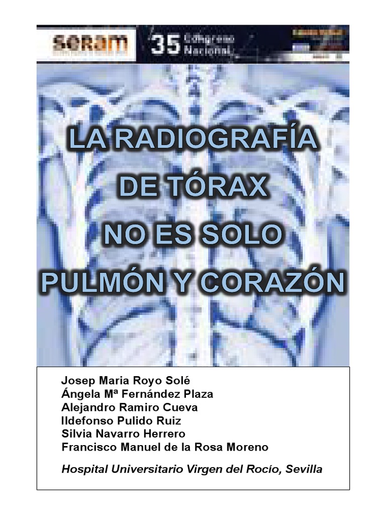 RX de Tórax No Solo Pulmón y Corazón | PDF | Tórax | Pulmón