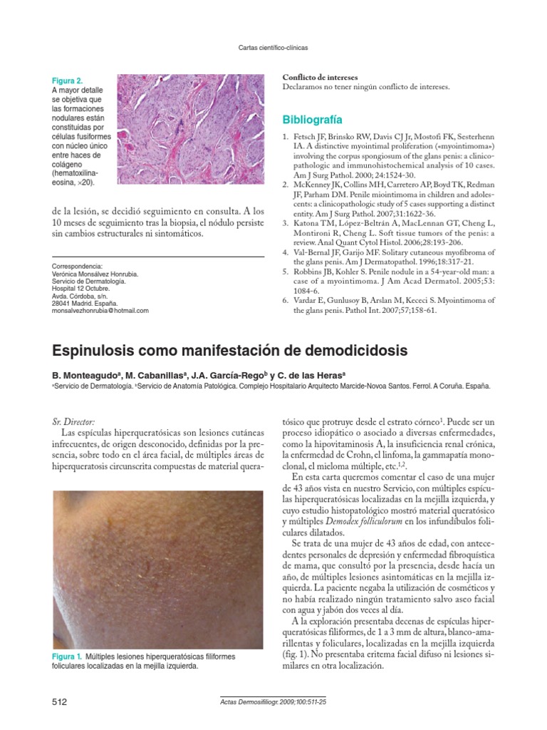 Espinulosis Como Manifestación de Demodicidosis: Bibliografía | PDF ...